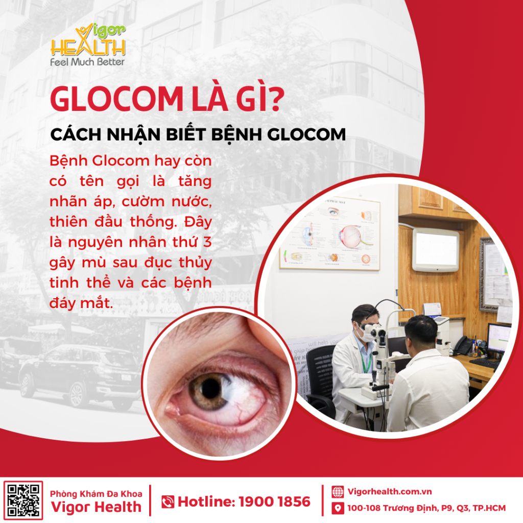 GLOCOM LÀ GÌ? CÁCH NHẬN BIẾT BỆNH GLOCOM - Phòng Khám Đa Khoa Vigor Health